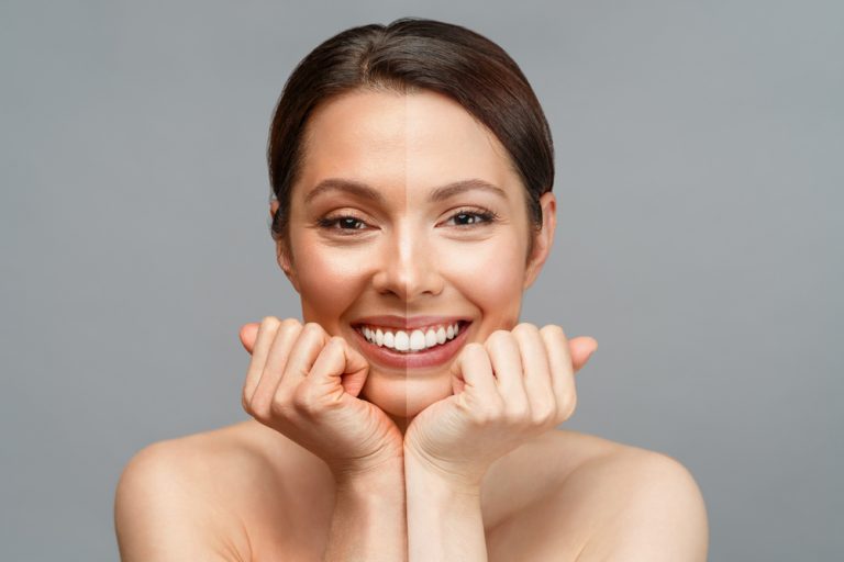 Face Bleaching Tips: Know The Essential Do’s And Don’t’s Of Bleaching ...